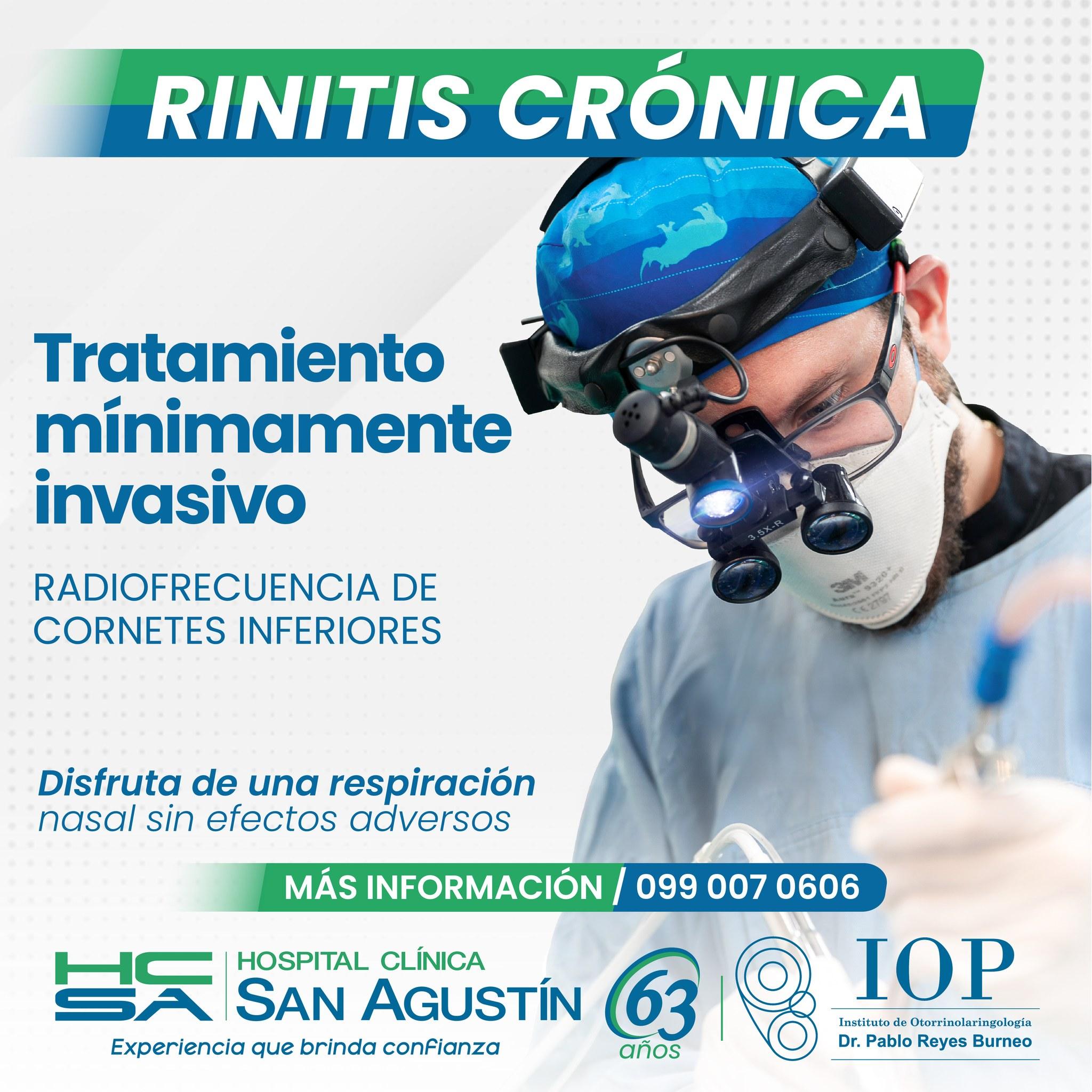 Rinítis Crónica – Hospital Clínica San Agustín en Loja